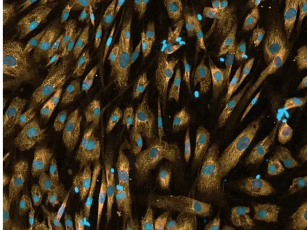 Lung Airway Models Newcells Biotech