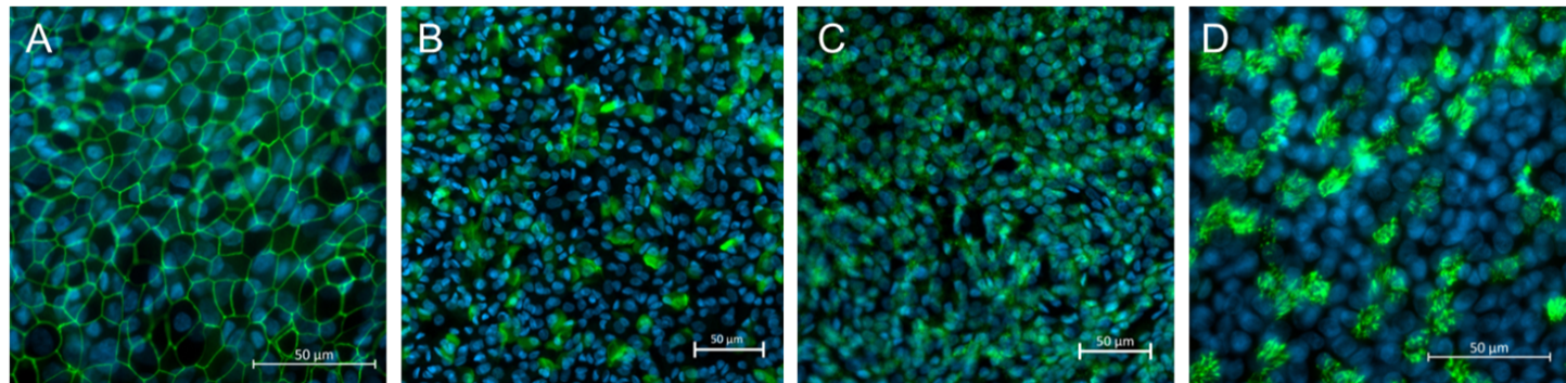 Small Airway Epithelial Cell Model | Newcells Biotech