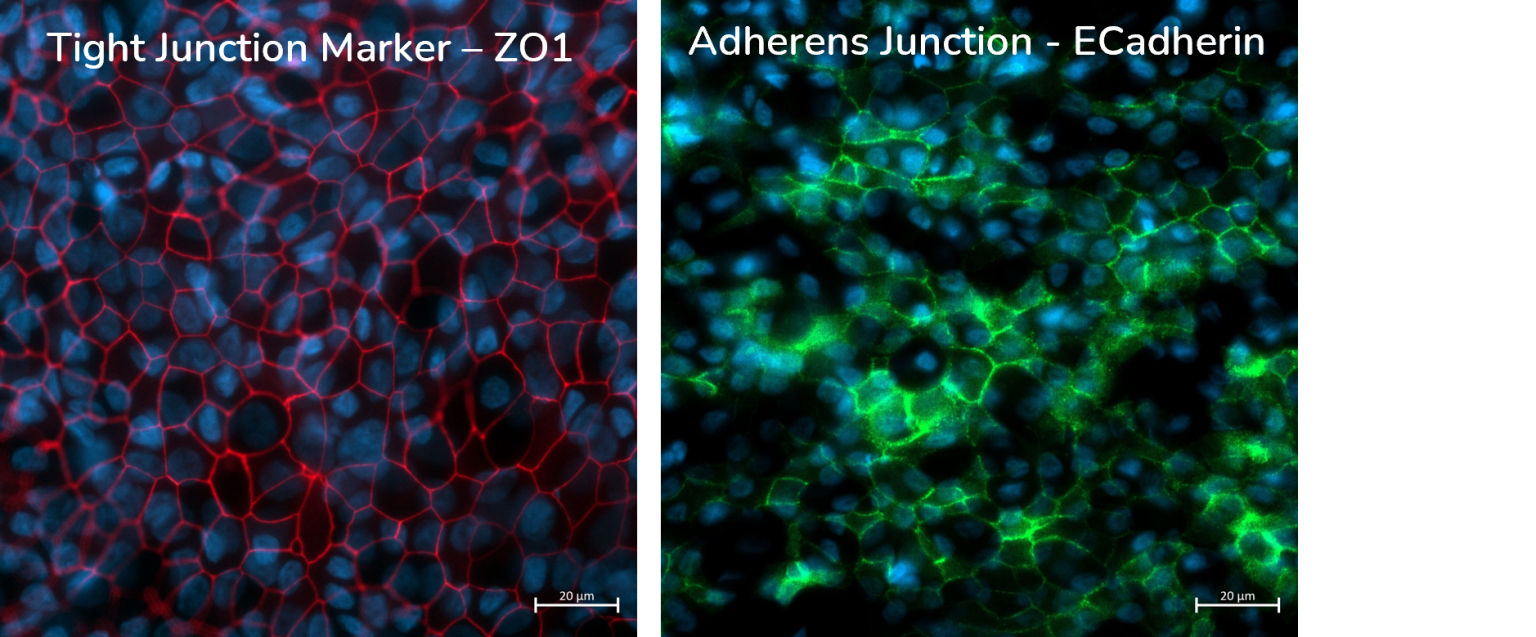 Small Airway Epithelial Cell Model | Newcells Biotech
