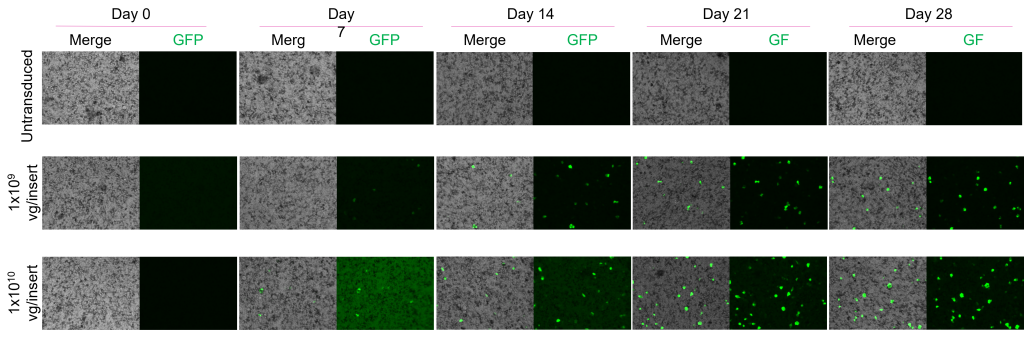 Gene Therapy Vector Assessment | Newcells Biotech